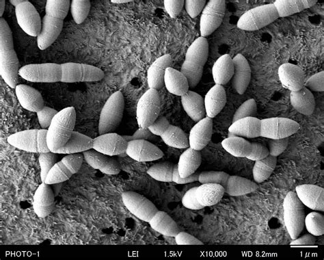 Gut Bacteria Strain Enhances Anticancer Drug Effectiveness Archyde