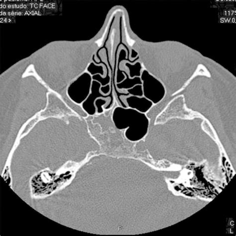 Differential Diagnosis And Treatment Of Isolated Pathologies Of The