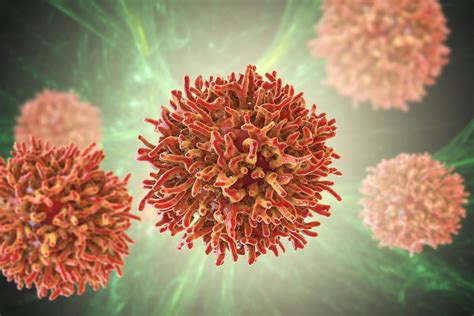 Local Sydney Council Probing Potential Cancer Cluster The Epoch Times