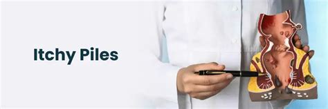 Itchy Piles Symptoms Causes And Treatment Options
