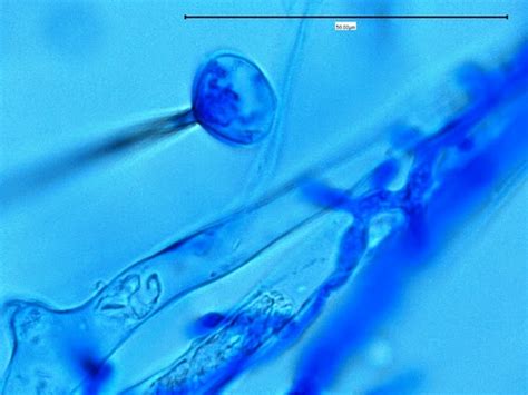 Fun With Microbiology Whats Buggin You Apophysomyces Elegans