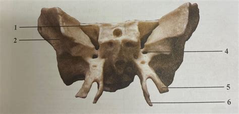 Sphenoid Bone Diagram Quizlet