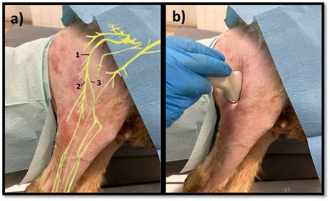 A Schematic Representation Of The Distribution Of The Sciatic Nerve Download Scientific