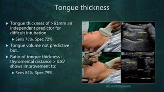Ultrasound And The Upper Airway Pptx
