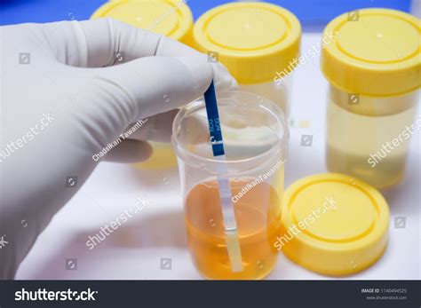 Pregnancy Test Positive Urine At Milla Anstey Blog