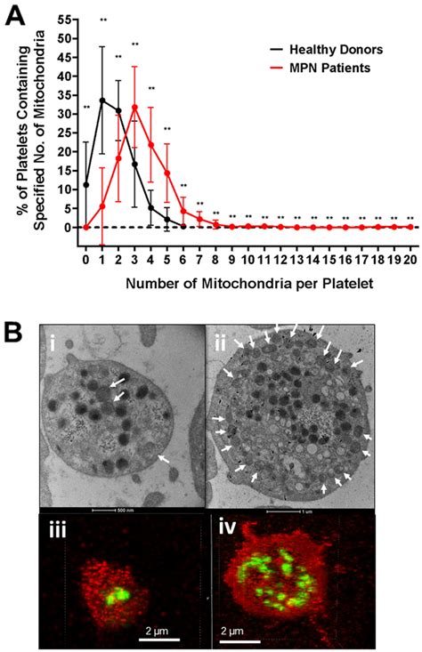 Increased Mitochondria In Platelets Of Mpn Patients A Tem Images Download Scientific Diagram