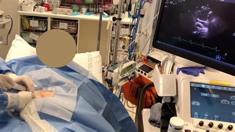 Pericardiocentesis Emergency Medicine Education Resus