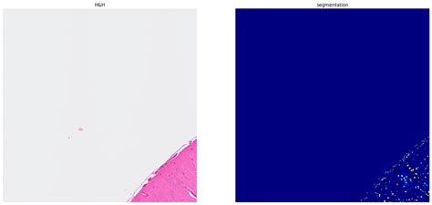 Nuclei Segmentation By Stardist Smurf