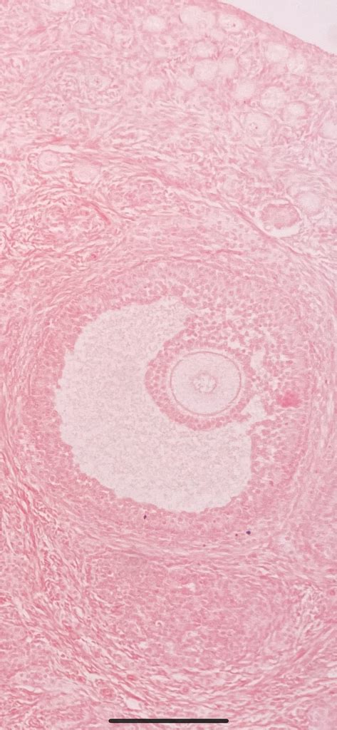 Tertiary Follicle Microscope Slide Diagram Quizlet
