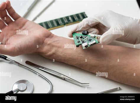 The Cosmetic Surgeon Made A Small Incision To Insert The Chip Into The