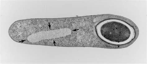 Figure 41 From Clostridium Perfringens Gastroenteritis Semantic Scholar