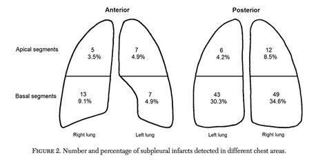 Pocus And Pe A Deep Dive
