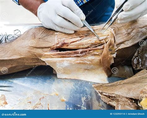 How To Dissect A Cadaver
