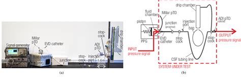Figure 1 From Distortion Of The Intracranial Pressure Waveform By
