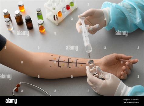 Doctor With Syringe And Ampule Making Allergy Skin Test To Patient In Clinic Closeup Stock