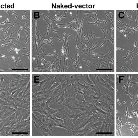 Representative Phase Contrast Microscopy Images Revealing The Phenotype Download Scientific