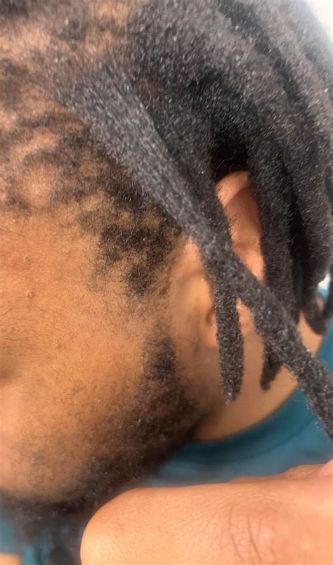 Feel Like This Loc Is Bout To Fall Off Of The Root Is Thinning Am I