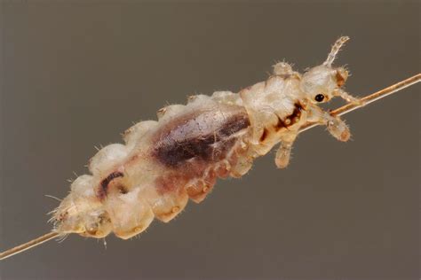 How Do Head Lice Look