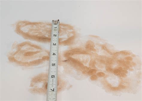 Silicone Prosthetic Thermal Burn Pack Wikedfx