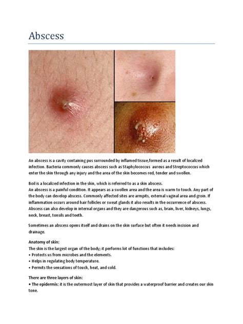 Abscess Skin Medical Specialties