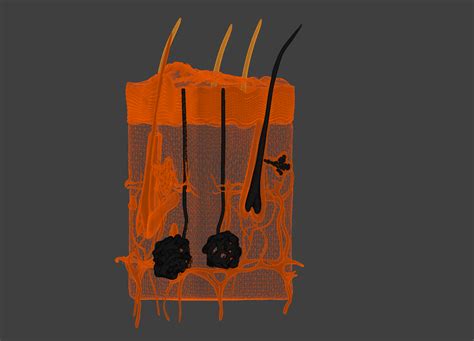 Stl File 3d Model Of Psoriasis Skin Cross Section Obj・3d Print Object To Download・cults