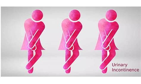 1 In 3 Women Experience Urinary Incontinence