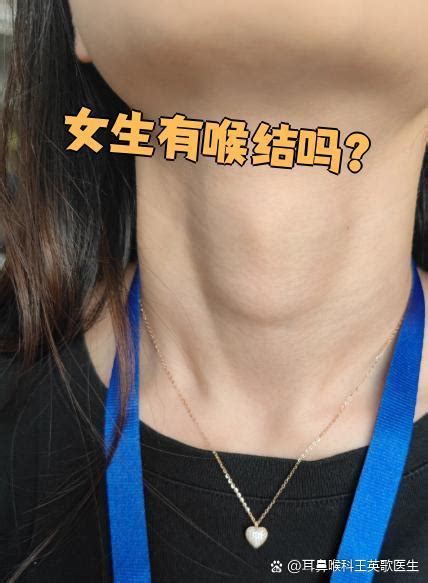 女生有喉结吗？