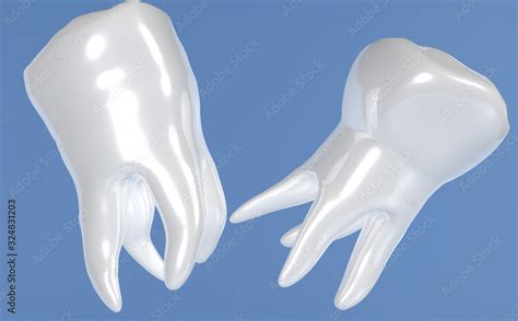 Tooth Lateral Front View Top View Bottom View Dental Implantation