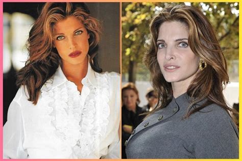 Stephanie Seymour Before And After Plastic Surgery