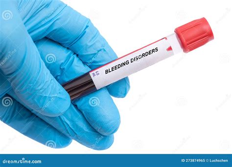 Bleeding Disorders Bleeding Disorders Disease Blood Test Stock Image