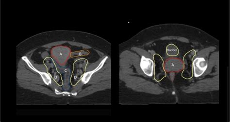 Ct Anatomy Study At Patricia Howard Blog