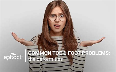 The Most Common Toe And Foot Problems Epitact
