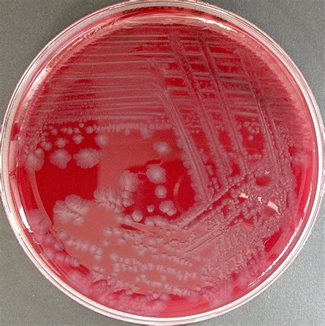 Clostridium Botulinum Prevention