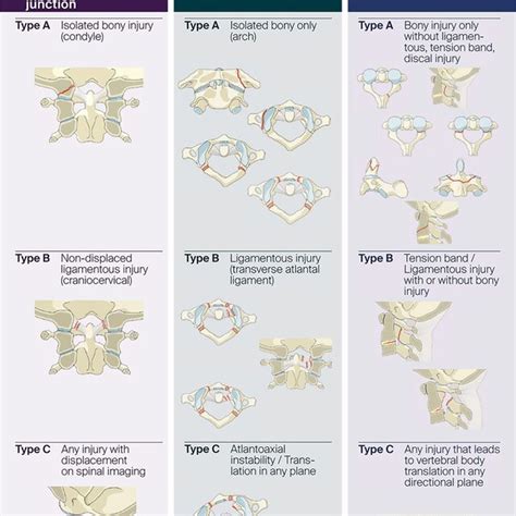 Depiction Of The Ao Spine Upper Cervical Injury Classification The