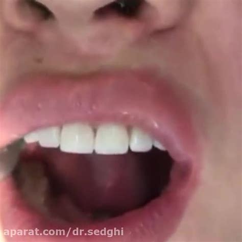 بررسی دندان دکتر لیلا صدقی دندانپزشک زیبایی تماشا