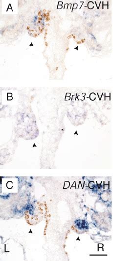 Expression Of Bmp Related Genes In Sex Indifferent Gonads Expression
