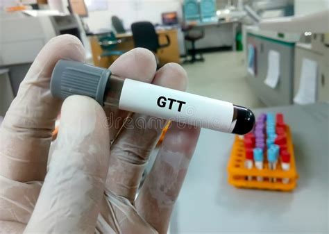 Technician Or Scientist Hold A Sample Tube Of Glucose Tolerance Test Or