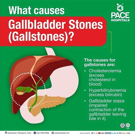 Gall Bladder Stone Symptoms