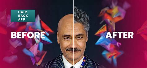 Taika Waititi Hair Transplant Did He Have Oneransplant Did He Have One Or Not