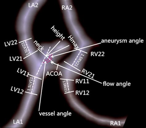 Frontiers Rupture Risk Assessment For Anterior Communicating Artery