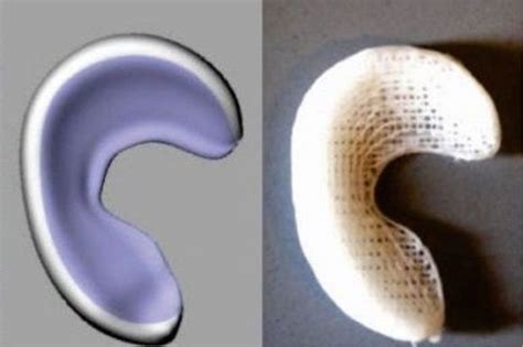 3d Printed Knee Meniscus Created By Doctors From Cumc Knee Meniscus