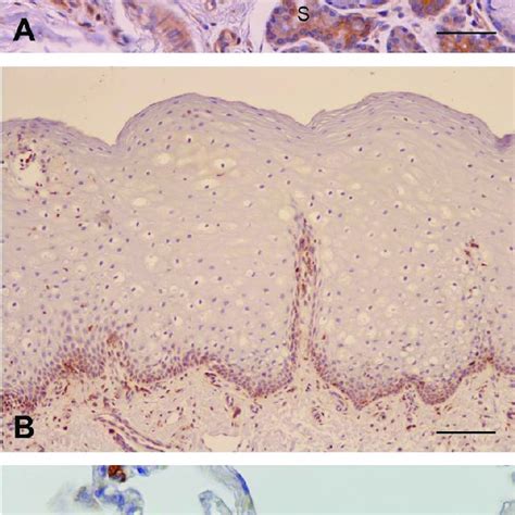 Labial Glands At Low A And High Magnification B C Hande Stain A Download Scientific