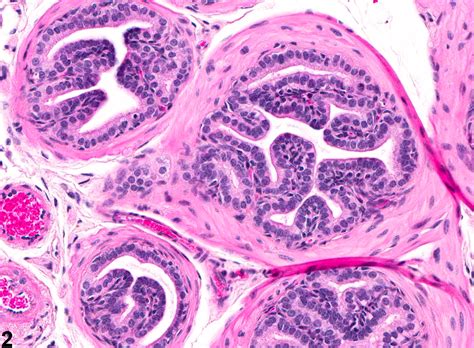 Seminal Vesicle Histology Labeled Seminalvesicleimages