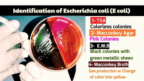 Confirmation Test For E Coli At Derek Herrman Blog