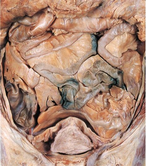 Small Intestine Dissection Diagram Quizlet