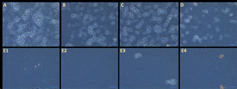 Asaio Platelet Aggregation Is Influenced By Nitric Oxide Loaded Liposome Nanoparticle Formulation