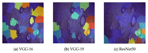 Classification Of Monkeypox Images Using Lime Enabled Investigation Of