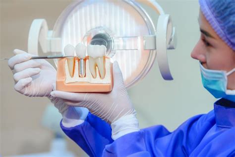 5 Reasons Dental Implants Are Superior To Other Teeth Replacement