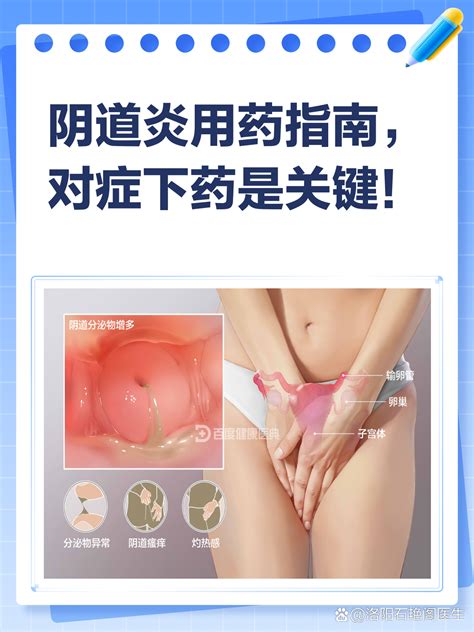 阴道炎用药指南💊，对症下药才有效！