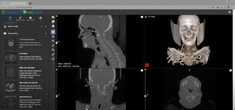 Kitware Inc On Linkedin Medicalvisualization Opensource Radiology Medicalimaging